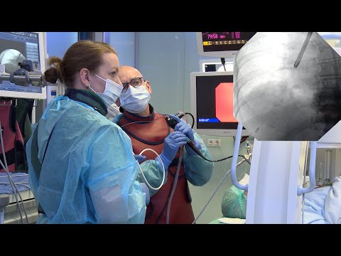 Transbronchial cryobiopsy with rigid intubation for ILD diagnosis, single-use cryoprobe and ERBECRYO