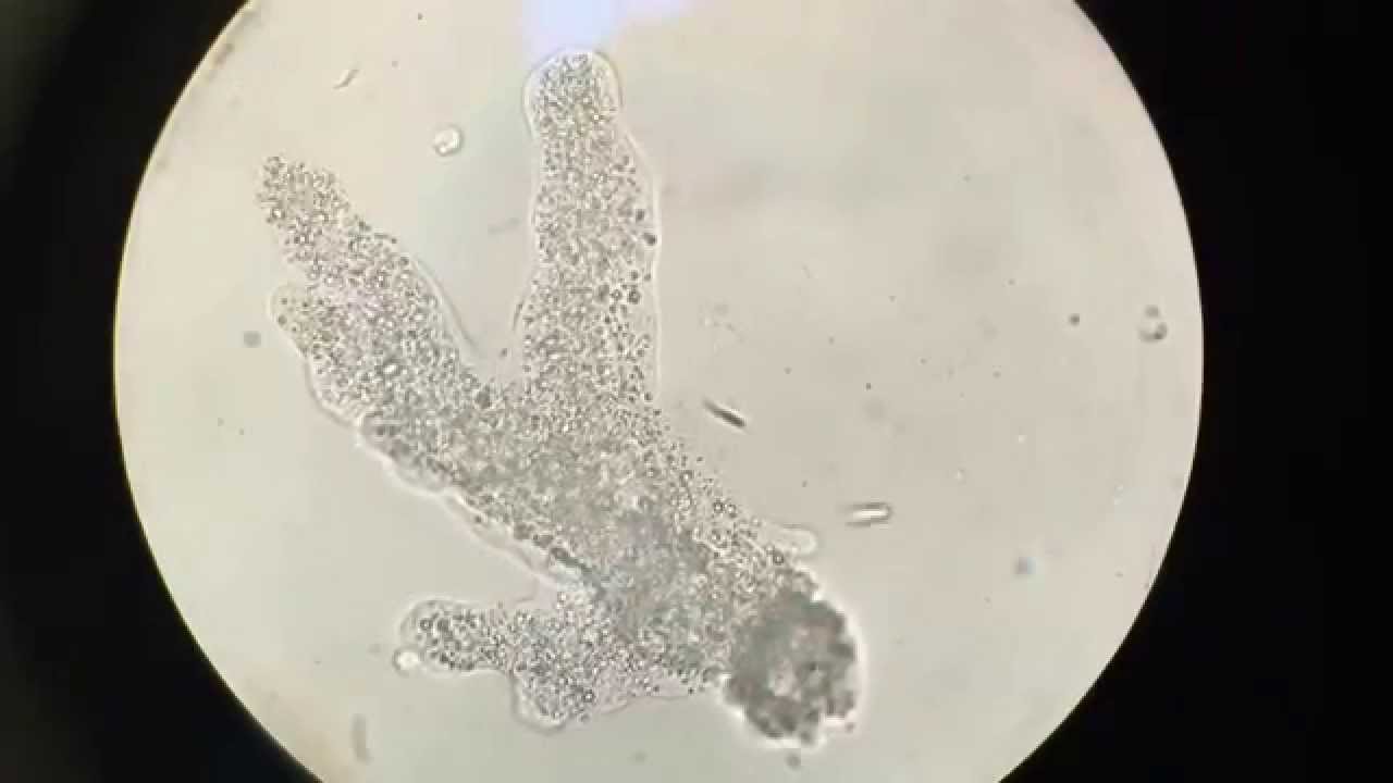 HD Amoeba at 40x, 100x, 200x, and 400x