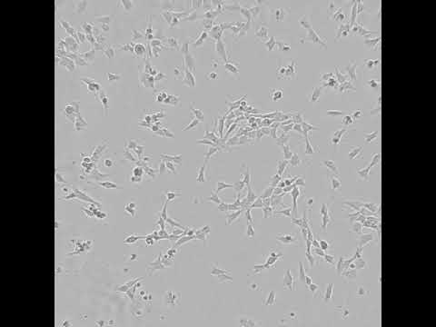 iPSC derived neural crest cell proliferation time-lapse | Using CytoSMART Lux2 live-cell imager