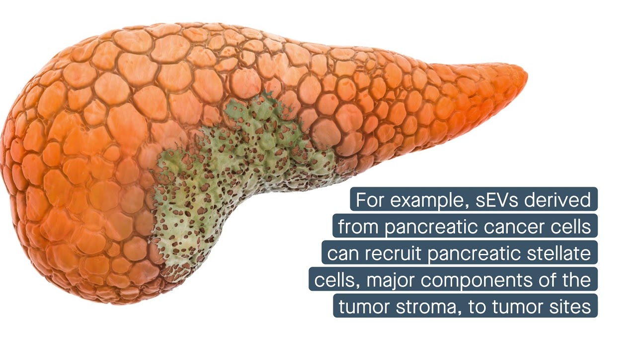 Small extracellular vesicles: Metastasis mediators and potential therapeutic tools