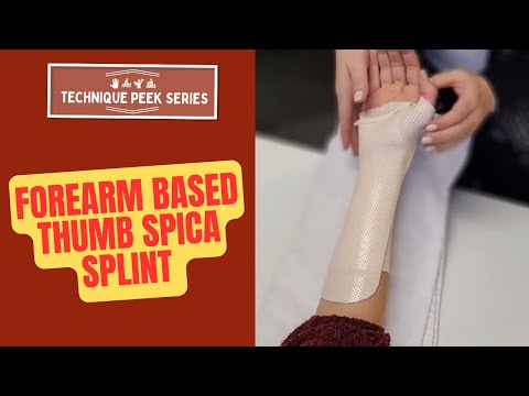 How to Create a Forearm-Based Thumb Spica Splint | Technique Peek Series