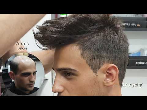 Hair Replacement fitting video (Alex) part 2 – Hair lnspira
