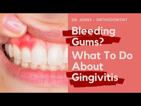 Dentist/Orthodontist Explains Bleeding Gums & What To Do About Gingivitis