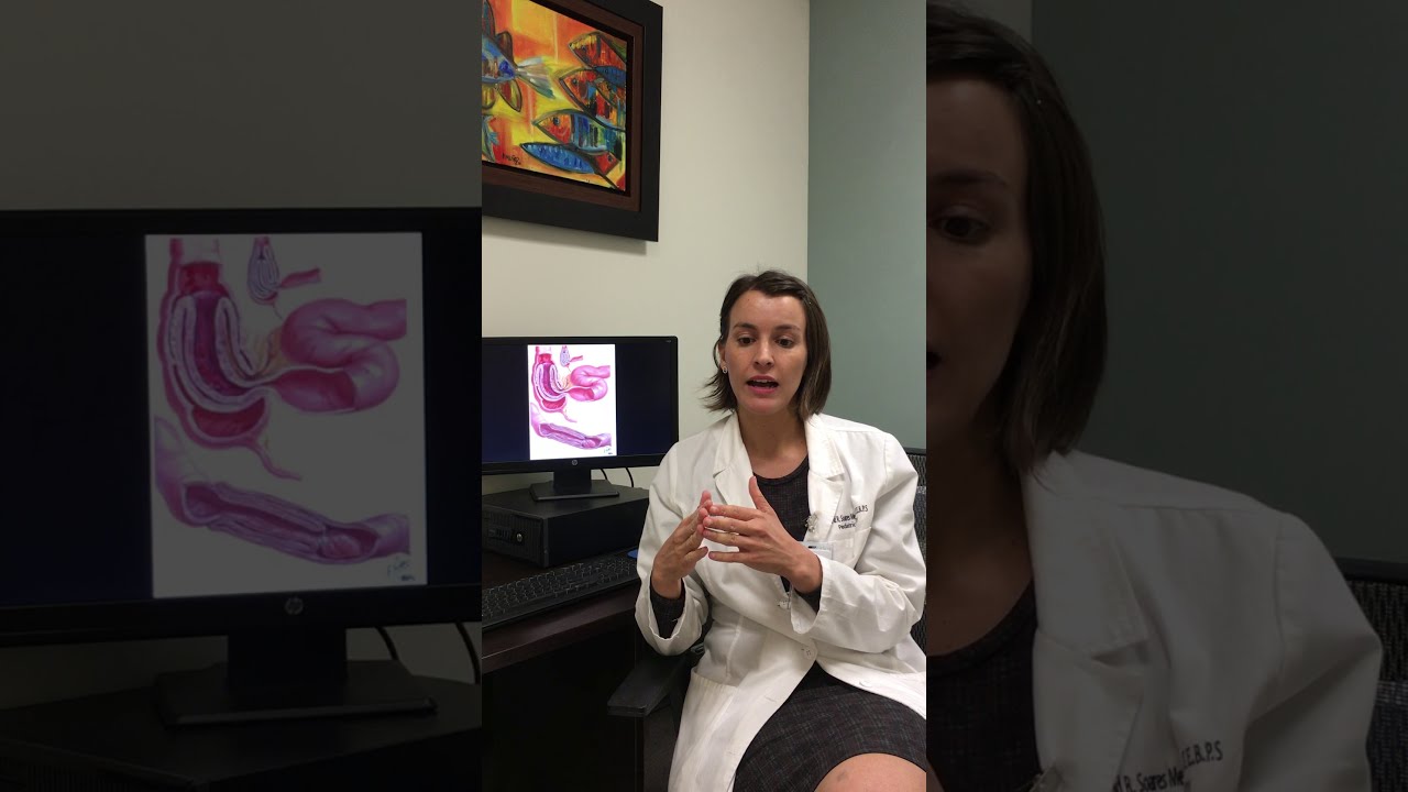 Cápsula Informativa: Invaginación Intestinal