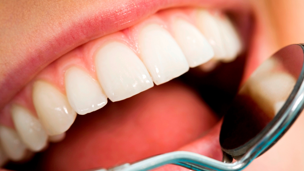Toothache East Palo Alto | (650) 481-6668 | Best East Palo Alto CA Dentist