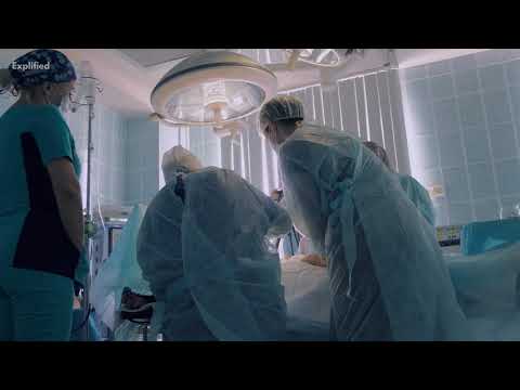 What Is Amputation: Amputation Meaning Explained