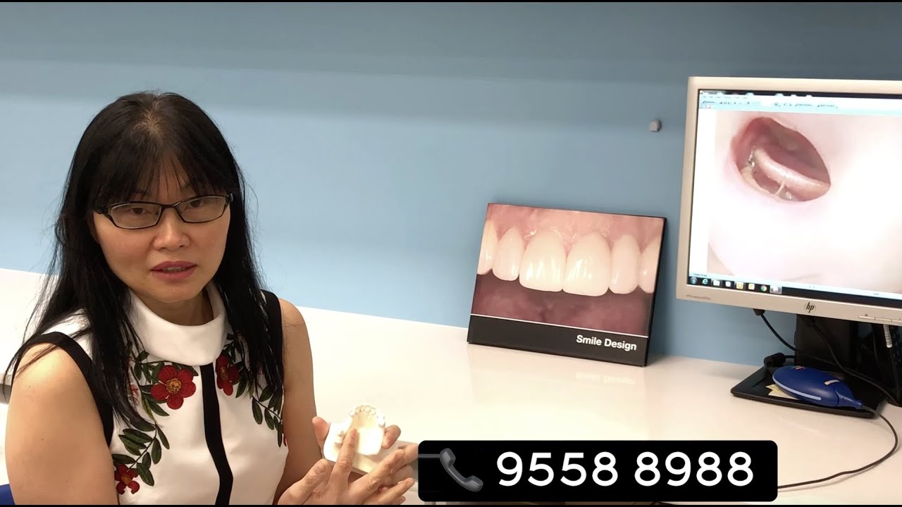 Tongue Tie Treatment - Pain Free Dentist Sydney