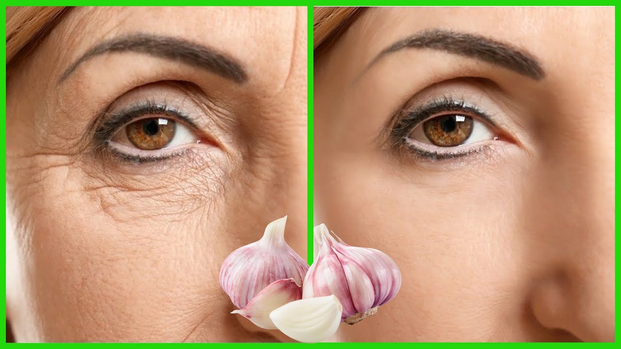 Did you know that garlic removes wrinkles forever? Remove wrinkles at home