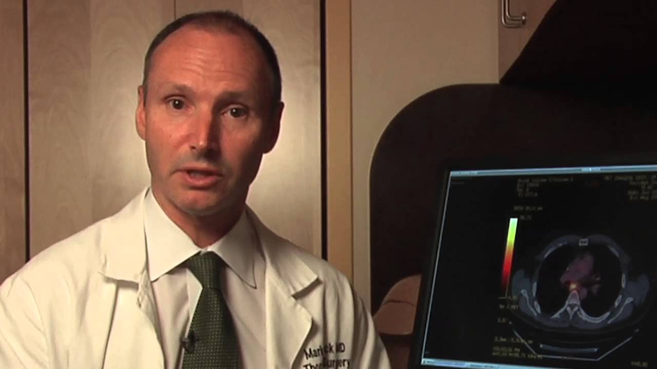 Mediastinal Staging for Lung Cancer