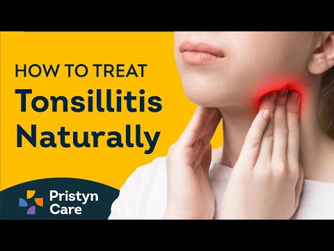 How to Treat Tonsillitis | Home remedies for Tonsillitis