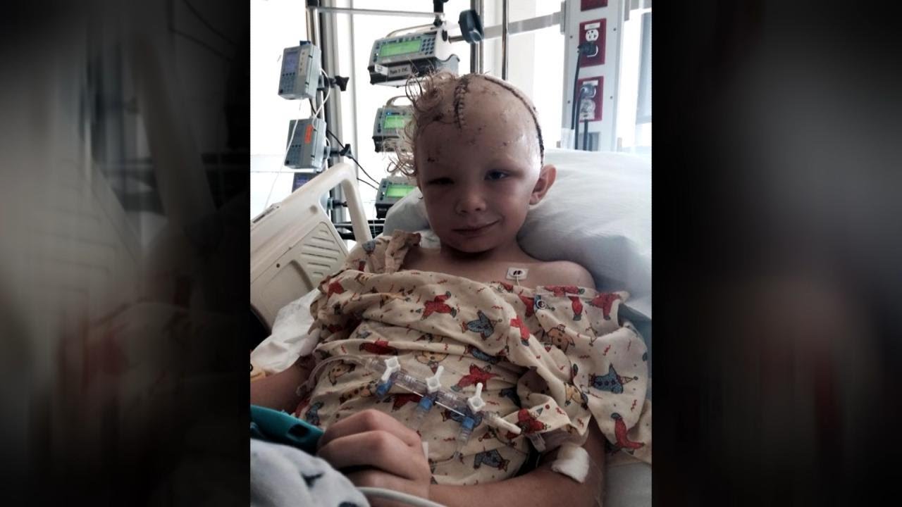 Meet the Boy with 3D Printed Skull