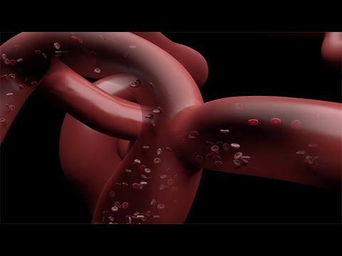 SC21: Visualization of Human-Scale Blood Flow Simulation Using Intel® OSPRay Studio on SuperMUC-NG