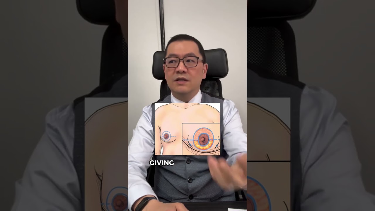 What are tuberous breasts?