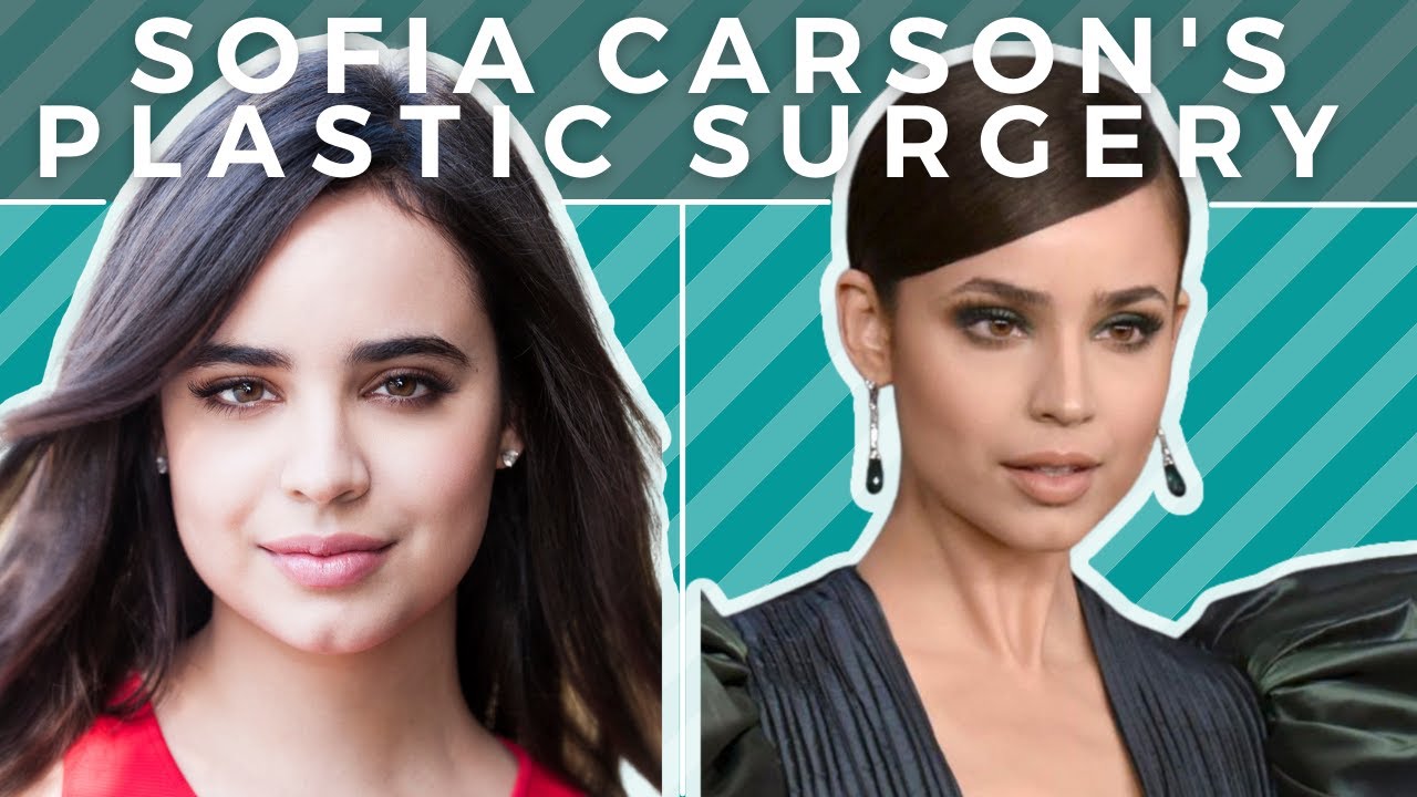 DISNEY PLASTIC SURGERY: Sofia Carson's Facial Transformation