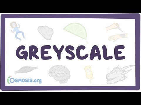 Greyscale – causes, symptoms, diagnosis, treatment, pathology – A Quick ...