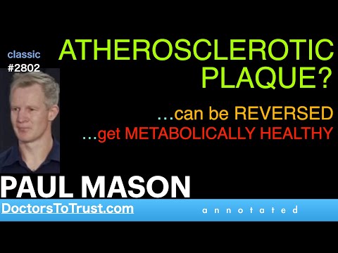 PAUL MASON | ATHEROSCLEROTIC PLAQUE? …can be REVERSED …get METABOLICALLY HEALTHY