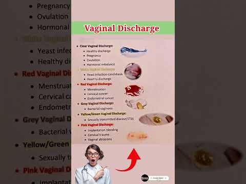 Types of Vaginal Discharge #medical #information #medicaleducation