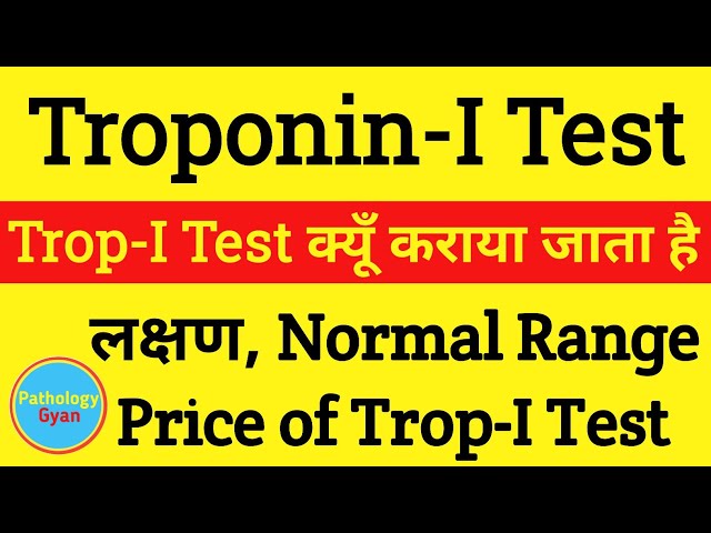 Rapid Test Kits - Tulip Amicheck Trop-I Rapid Test Device Trader ...