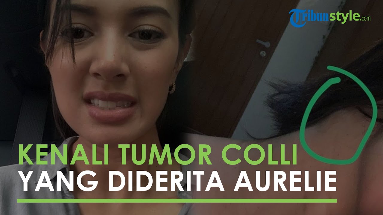 Mengenal Tumor Colli Penyakit yang Diderita Aurelie Moremans, Bisa Jadi ...
