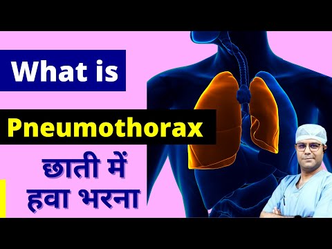 🏀 What is Pneumothorax ? छाती में हवा भरना क्या है #shorts #pneumothorax