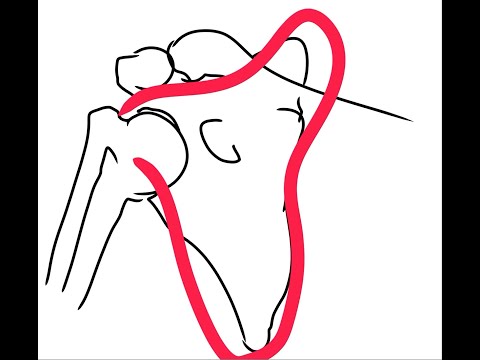 Shoulder abduction problems - Scapular and muscular relations