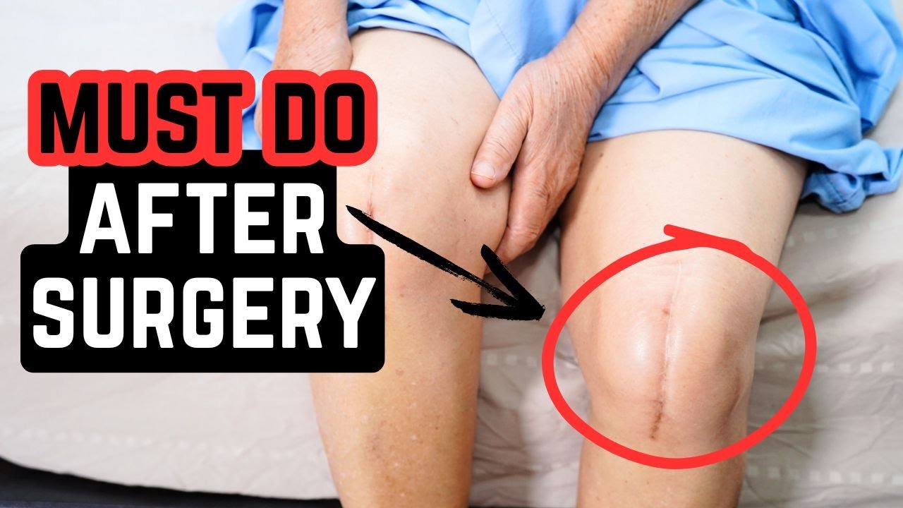 How To Make A Knee Replacement Scar Look Good and Feel Good.