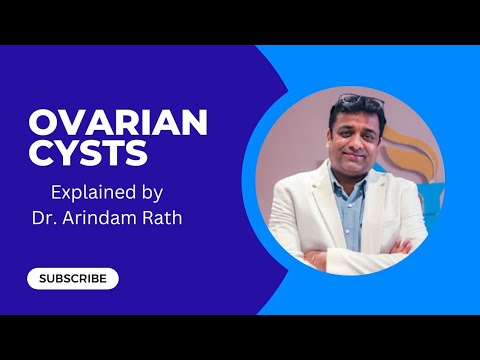 Ovarian Cysts: What They Are, How To Detect Them, And How To Treat Them