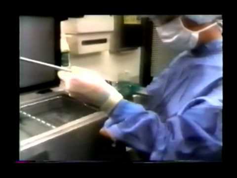 Ultrasonic Cleaners Medisafe Sonic Irrigator PCF Forums | MedWrench