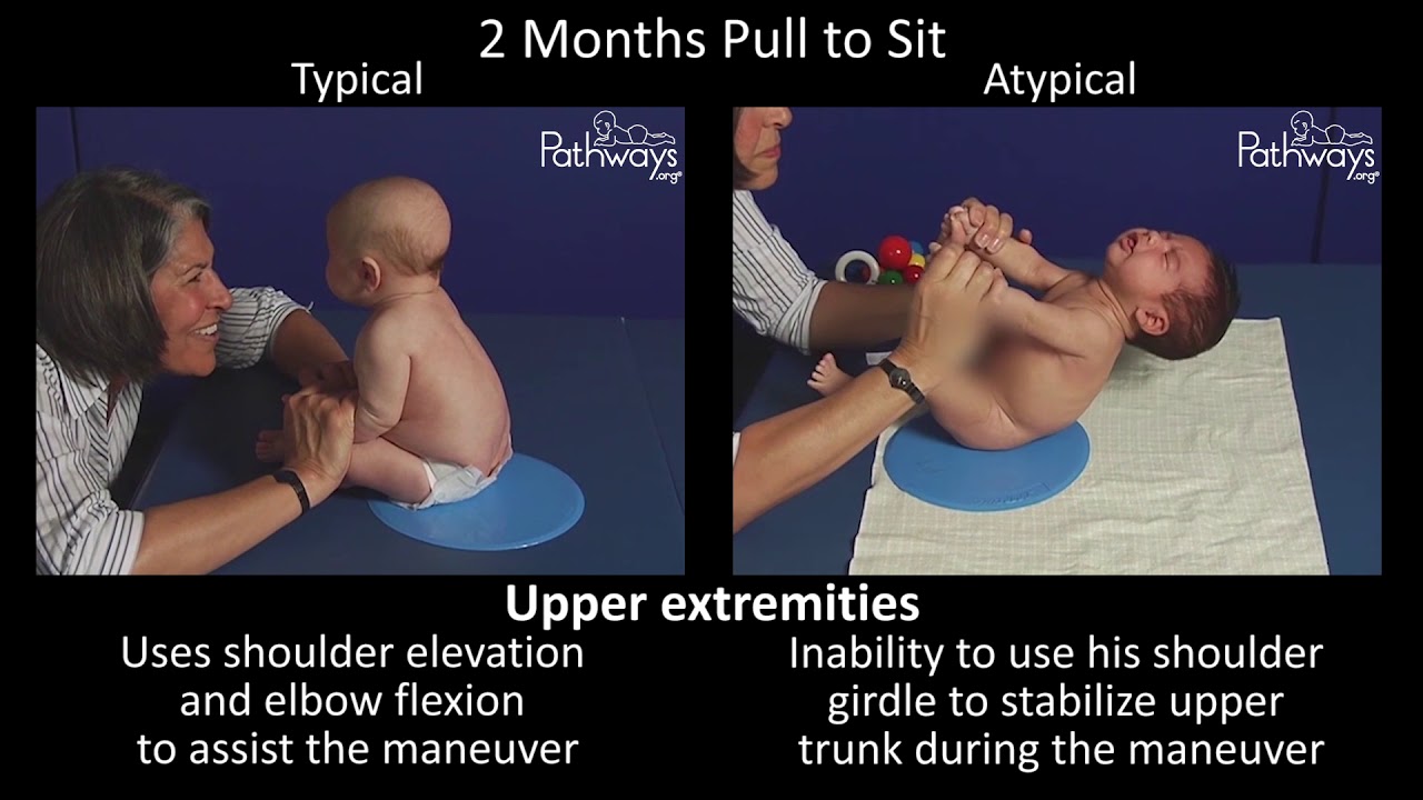 2 Month Old Baby Typical & Atypical Development Side by Side