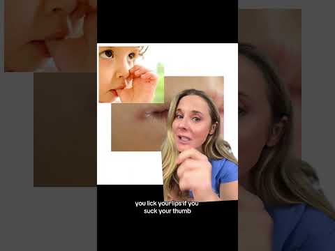 These are not chapped lips.. it’s angular cheilitis. #chappedlips #angularcheilitis
