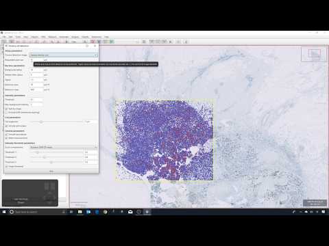 15 - Recovering parameters from the Workflow history
