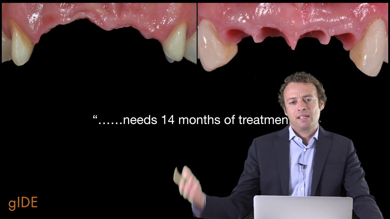 314-00 Soft Tissue Management Around Implants PREVIEW