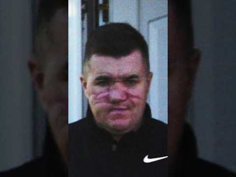 The Scarface of Scotland: The Untold Story of Steven 'Bonzo' Daniel