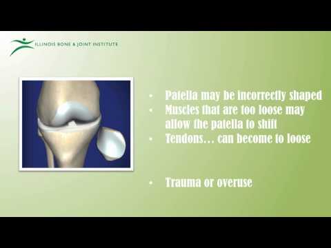 Patellar Tracking Disorder