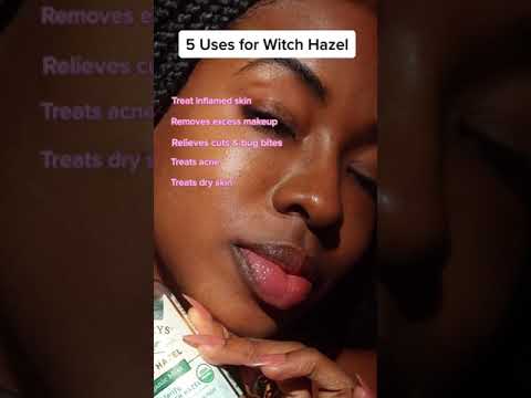5 USES FOR WITCHHAZEL #SHORTS #SHORTS30
