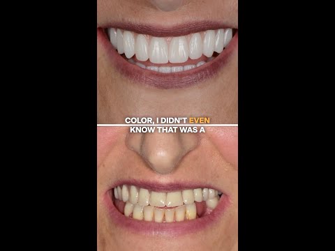 Customize Your Smile