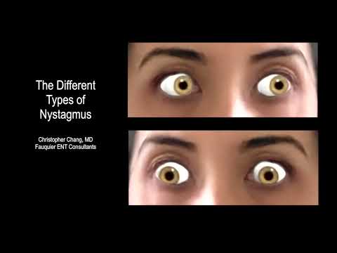 Types of Nystagmus Due to BPPV Vertigo (What it Looks Like, Which Side, & Which Maneuver?)