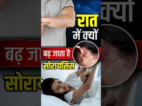 🌃रात में क्यों📈बढ़ जाता है सोरायसिस?| Causes of Skin Psoriasis | Karma Ayurveda | #shorts #skincare