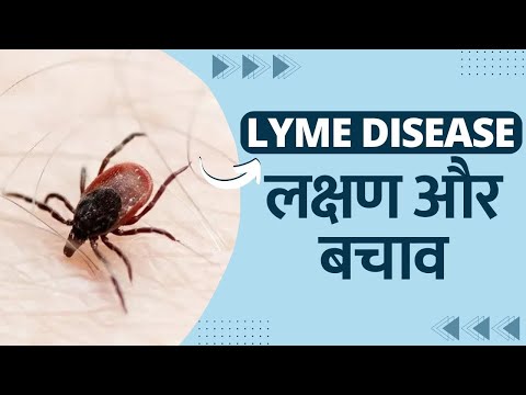 Lyme Disease: क्या है लाइम रोग? जिससे सुपरमॉडल Bella Hadid पिछले 15 सालों  से हैं पीड़ित
