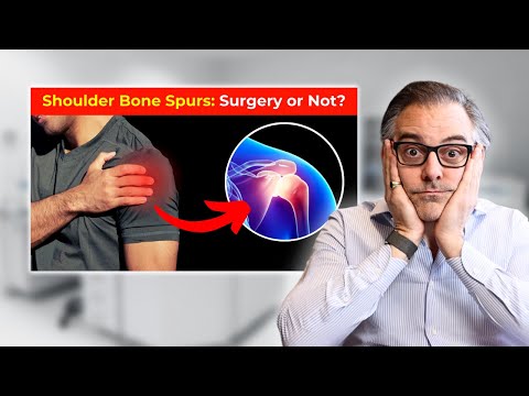 Shoulder Bone Spurs: Causes, Treatments & When to See a Doctor | @PeterDeNobleMD Explains