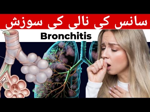 Bronchitis in Hindi/Urdu: Causes, Symptoms, Bronchitis Treatment?