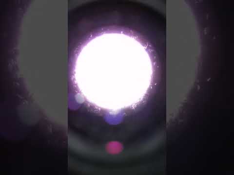 Epithelial cells in urine under the microscope