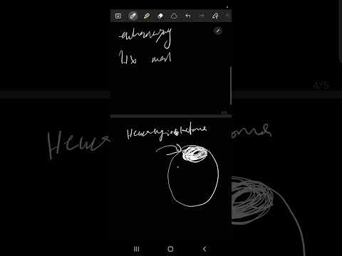 Neuroradiology - Posterior fossa mass in adult DD