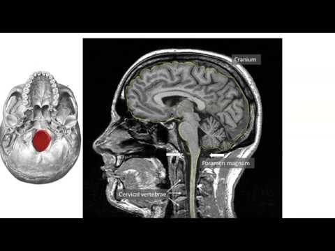 Regions of the brain