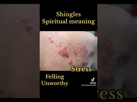 #gabbinwithgabbie #shingles #fyp