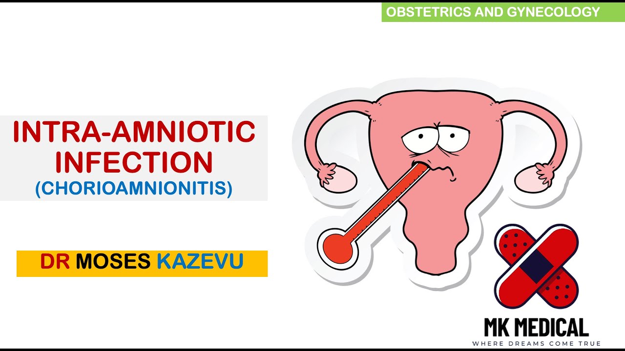 Chorioamnionitis (Intra-amniotic infection)