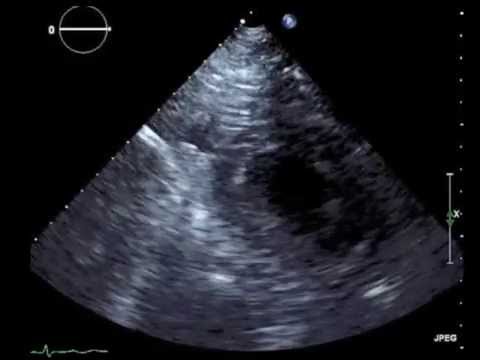 Transthoracic Echocardiography
