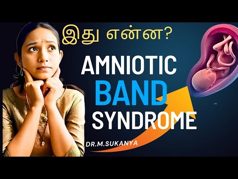 கர்ப்பகால அம்னோடிக் பாண்ட் ஆ🤔 Amniotic band syndrome in Tamil by Dr Sukanya MBBS.PGDUSG.CCAM(LONDON)