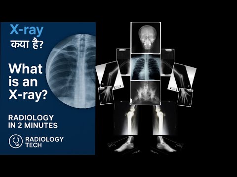 X-Rays explained in 2minutes | X-Rays made simple