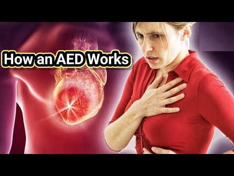How an AED works🫀#cardiology #youtube #youtubeshorts #doctor #youtubevideo #anatomy